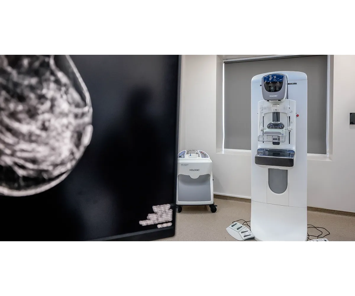 Digital mammography - tomosynthesis - ico